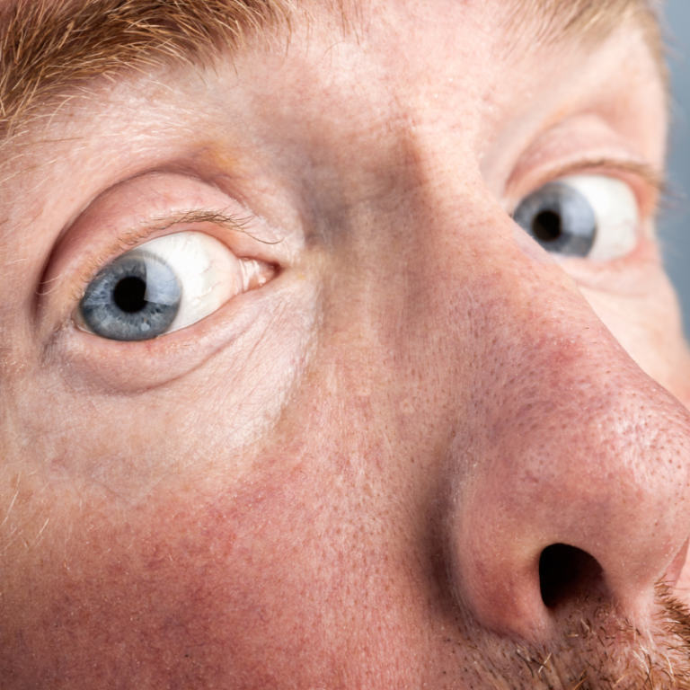 Understanding Age-Related Vision Loss and How to Help
